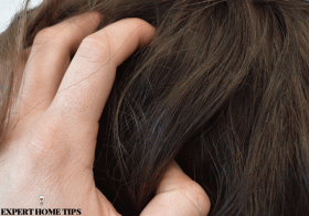 How To Get Rid Of Nits (Head Lice Treatments That ACTUALLY Work ...